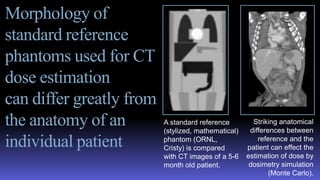 Rsna2012 pediatric dosemapvstdphantom | PPTX