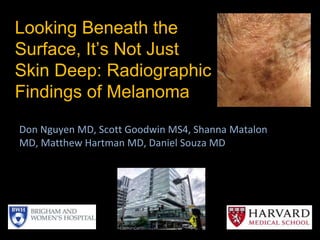 Radiographic Findings of Melanoma | PPTX