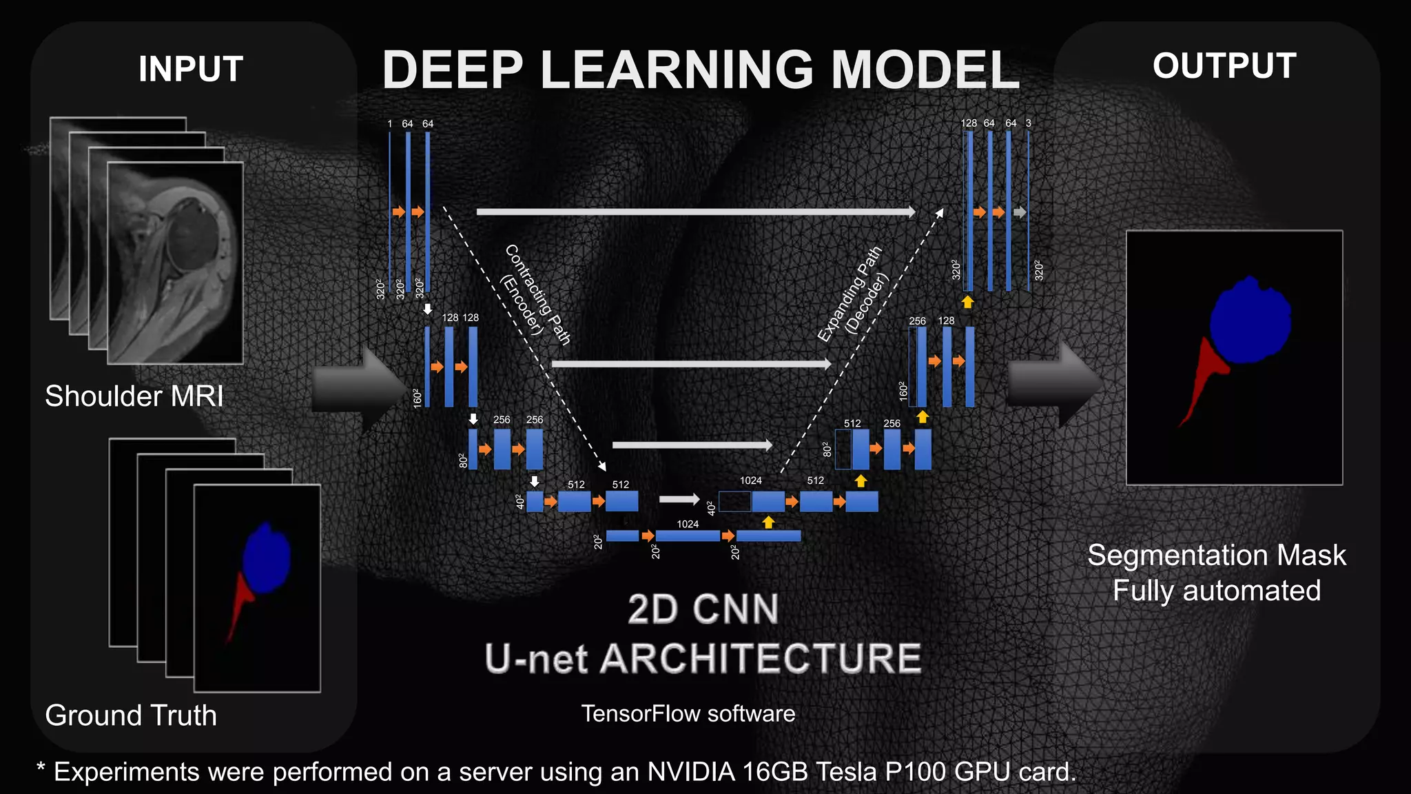 Fully Automated Mri Bone Segmentation Of Glenoid And Humeral Head Using Deep Convolutional