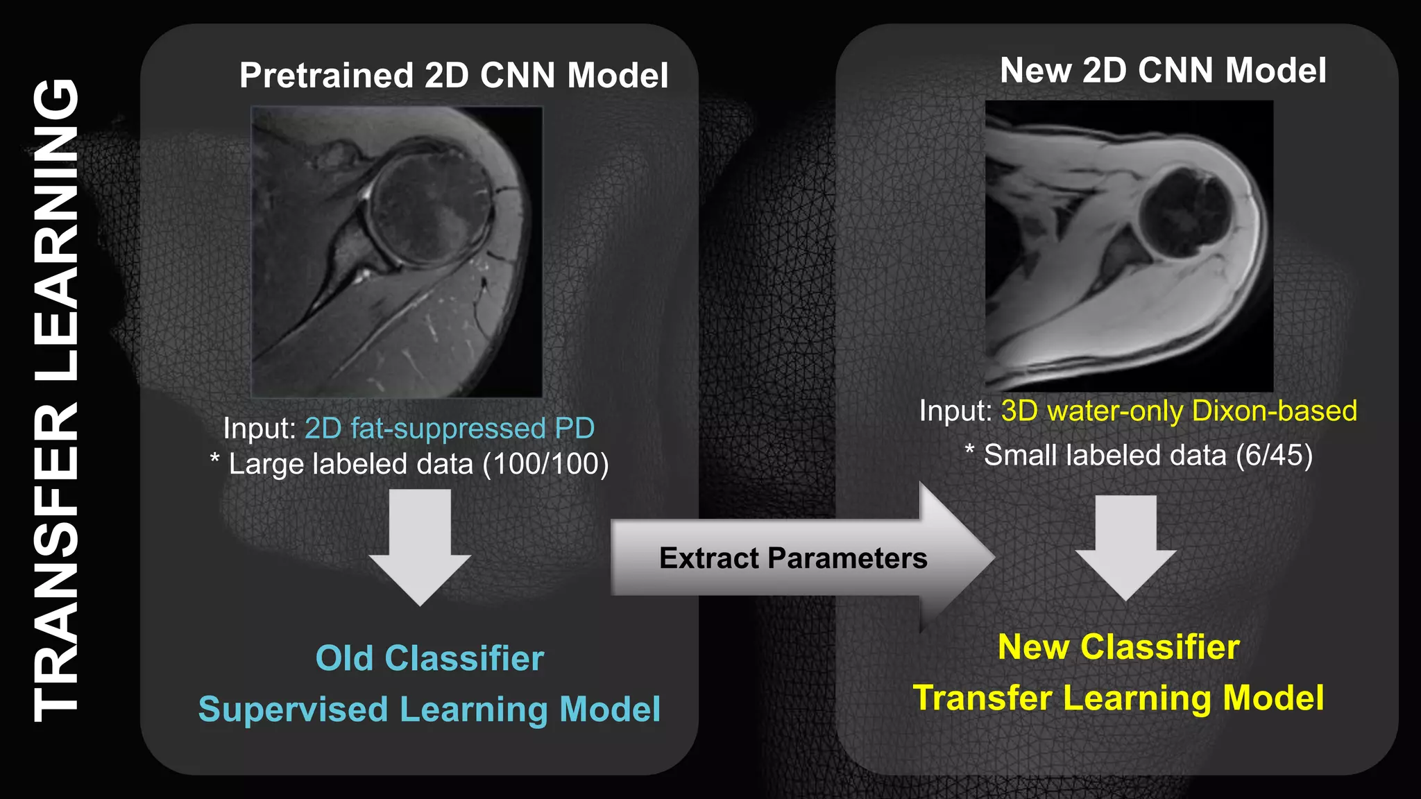 Fully Automated Mri Bone Segmentation Of Glenoid And Humeral Head Using Deep Convolutional