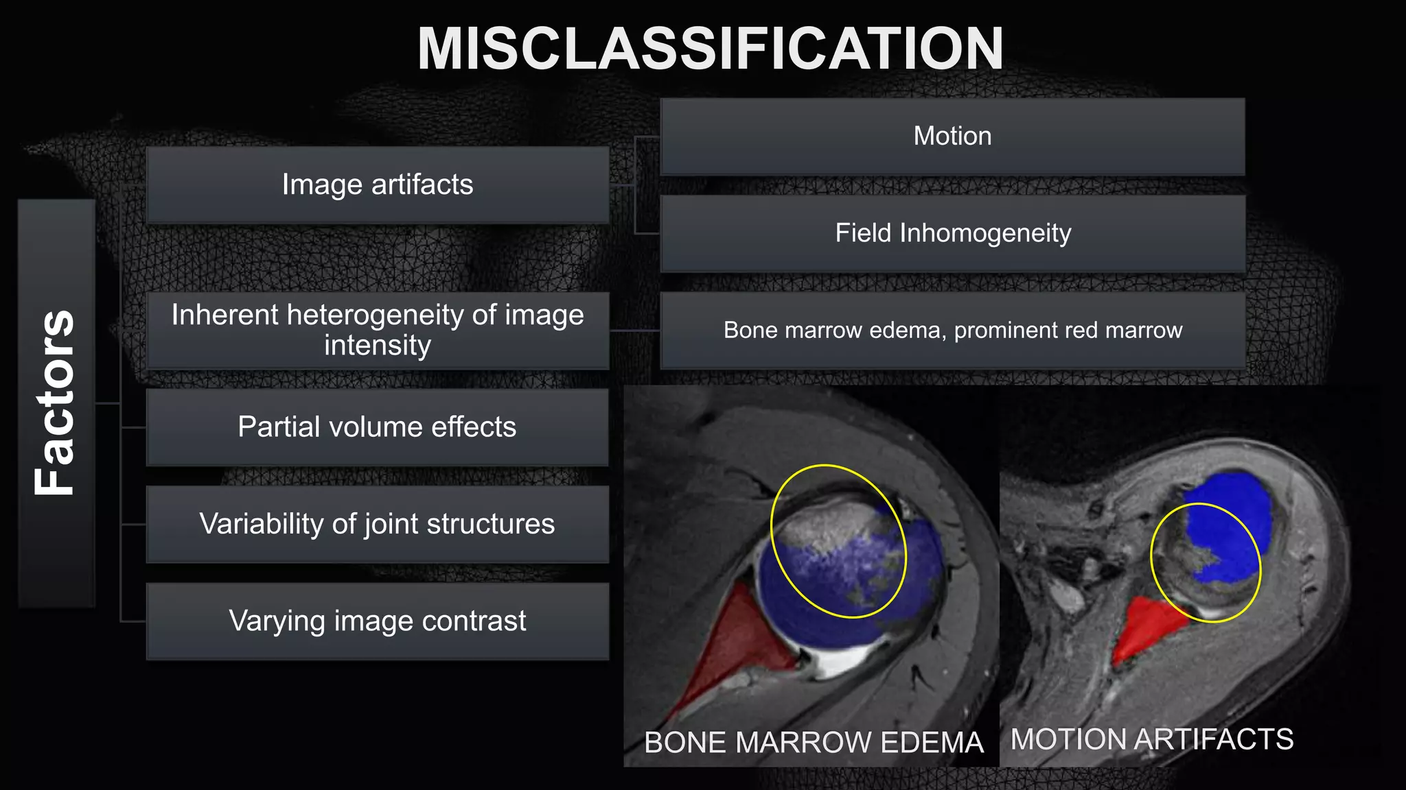 Fully Automated Mri Bone Segmentation Of Glenoid And Humeral Head Using Deep Convolutional