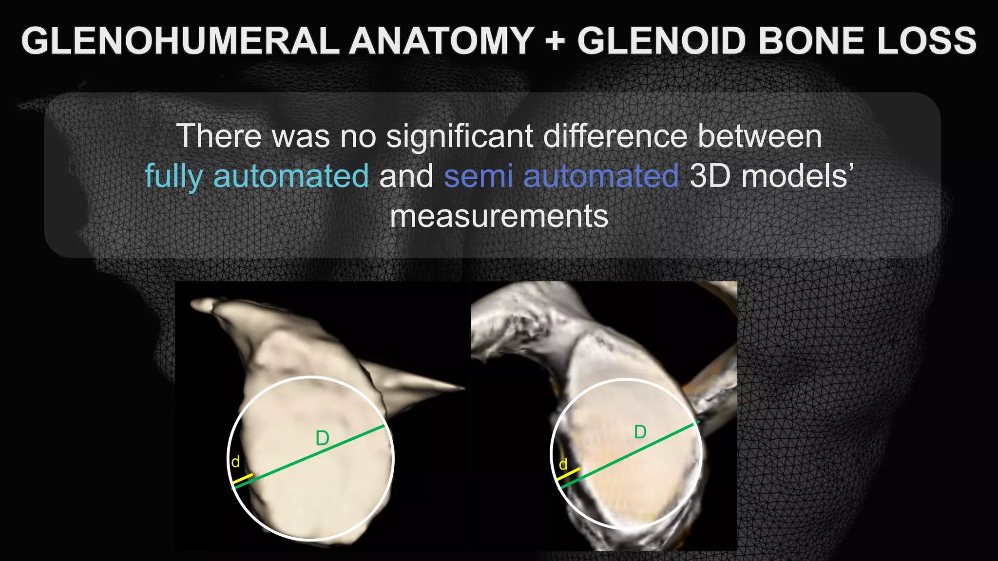 Fully Automated Mri Bone Segmentation Of Glenoid And Humeral Head Using Deep Convolutional