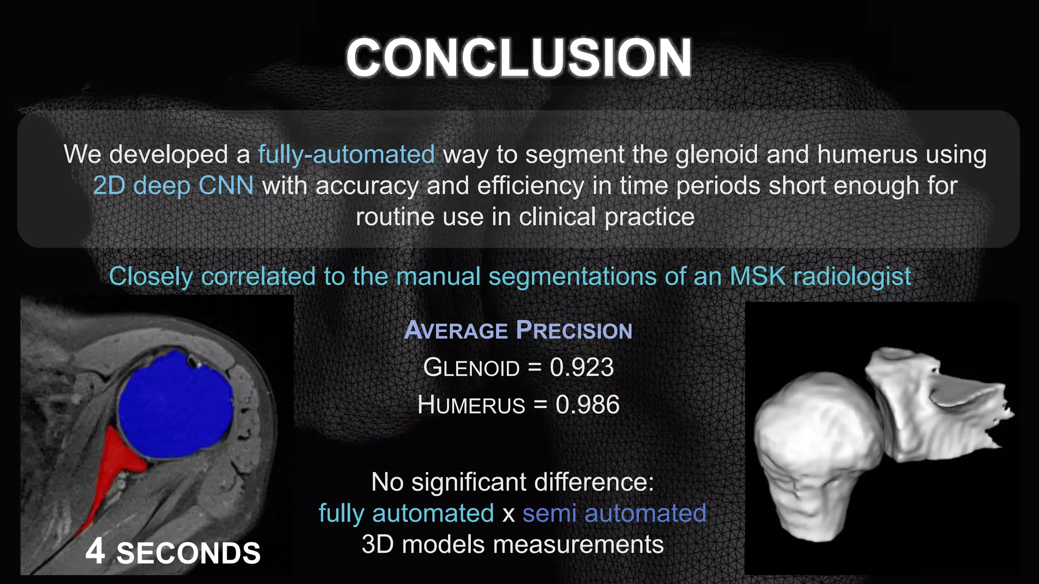 Fully Automated Mri Bone Segmentation Of Glenoid And Humeral Head Using Deep Convolutional