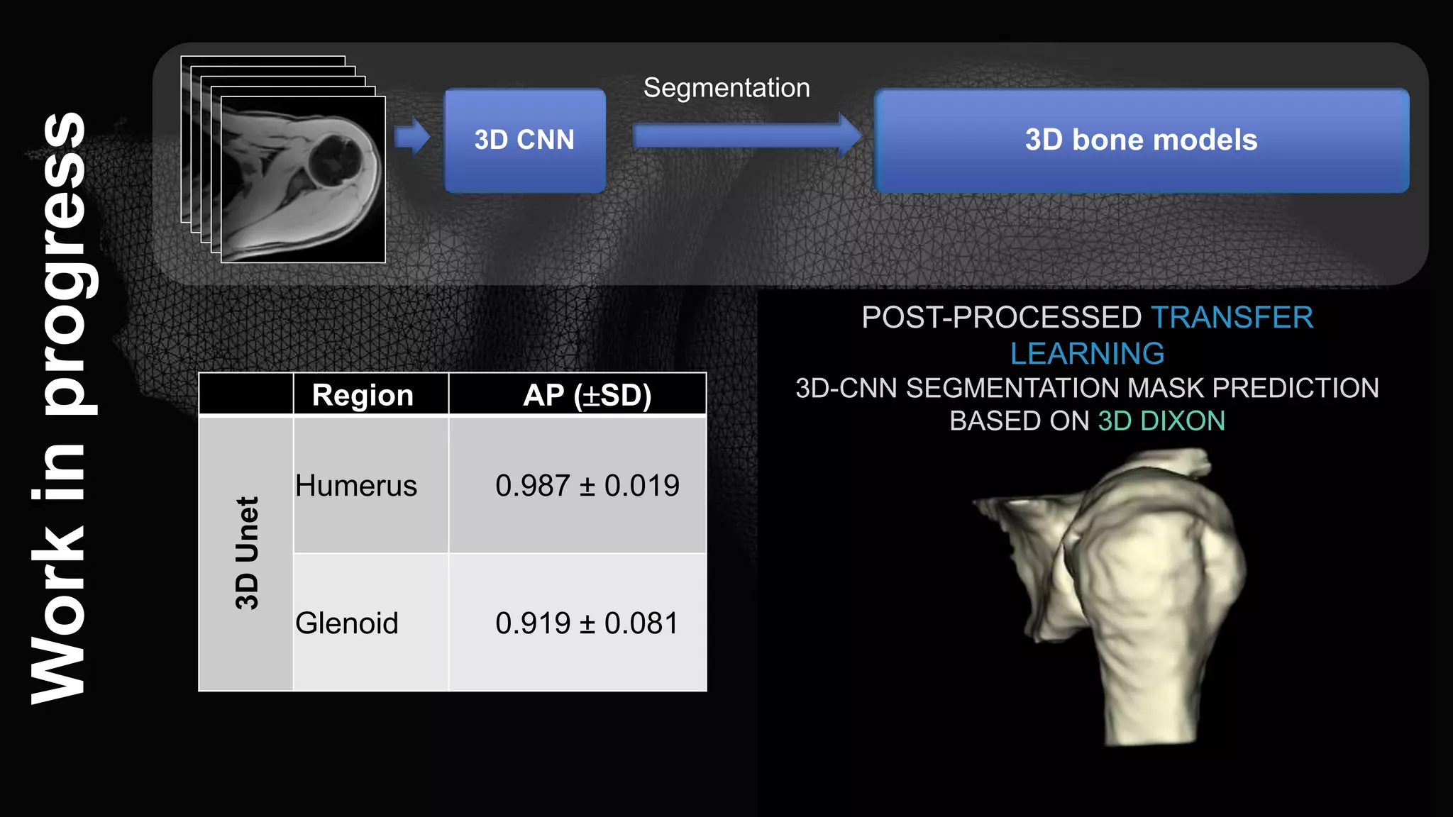 "Fully Automated MRI Bone Segmentation of Glenoid and Humeral Head ...