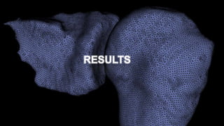 "Fully Automated MRI Bone Segmentation of Glenoid and Humeral Head using Deep Convolutional ...