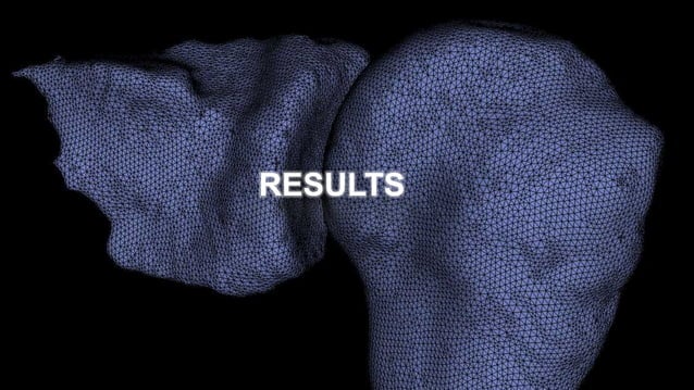 Fully Automated Mri Bone Segmentation Of Glenoid And Humeral Head