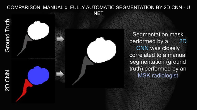 Fully Automated Mri Bone Segmentation Of Glenoid And Humeral Head