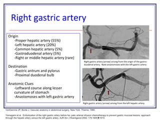 Left Gastric Artery Angiogram