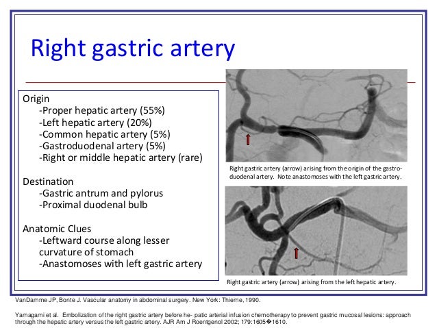 Right Gastric Artery
