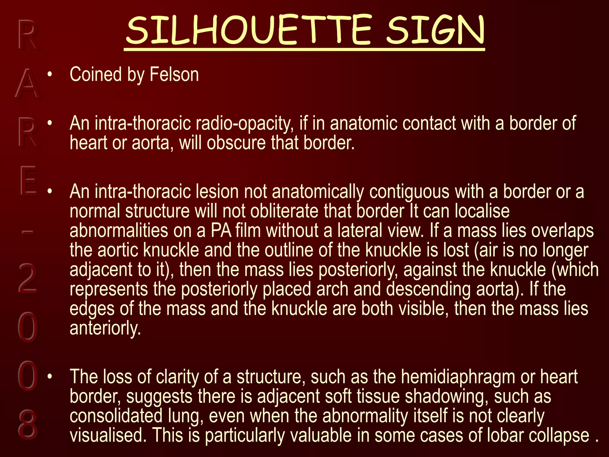 Respiratory system signs final.ppt radiology | PPT