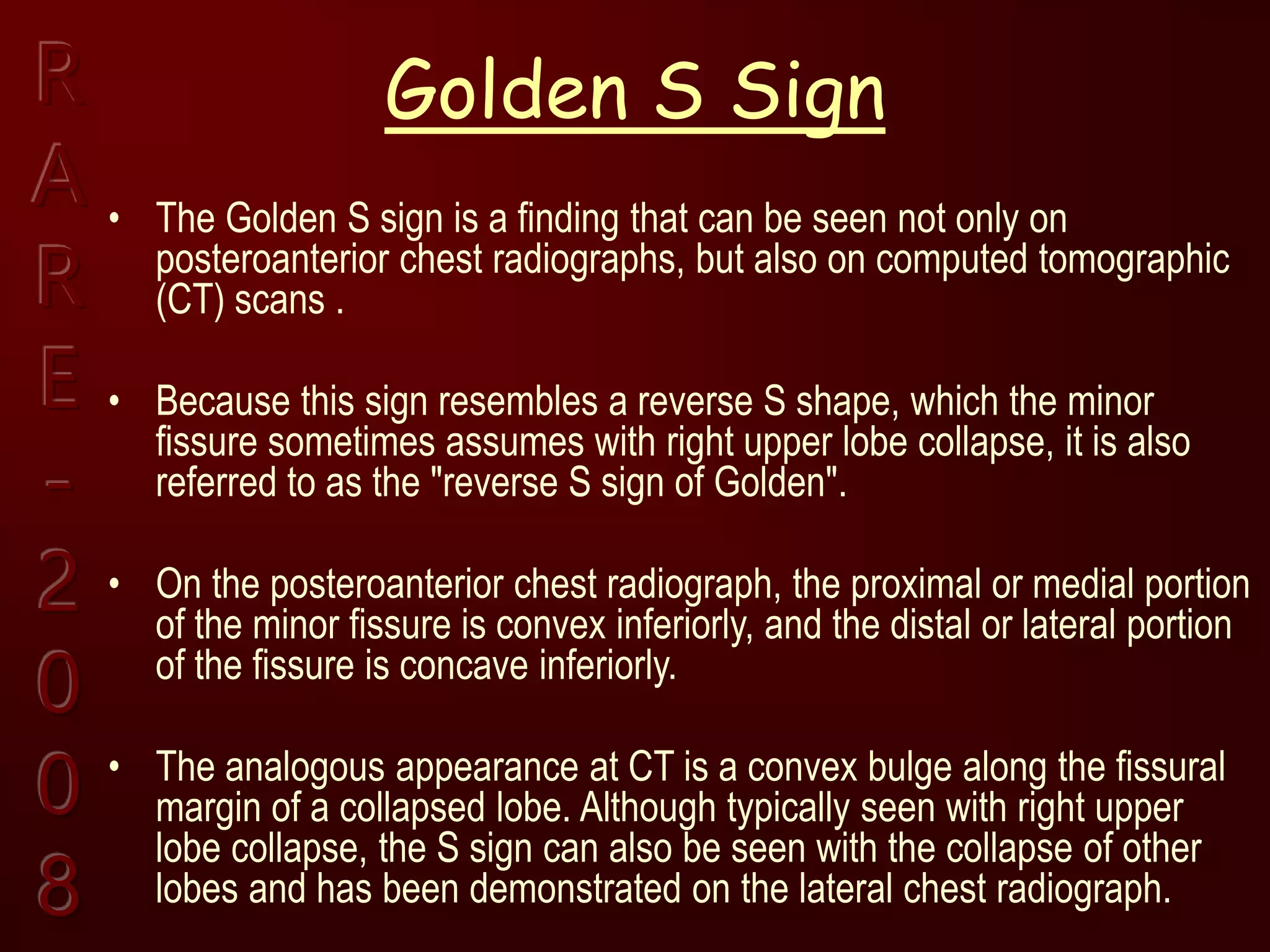 Respiratory system signs final.ppt radiology | PPT