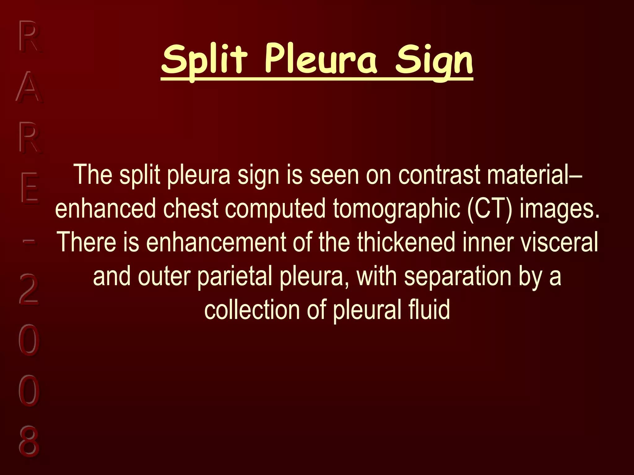 Respiratory system signs final.ppt radiology | PPT