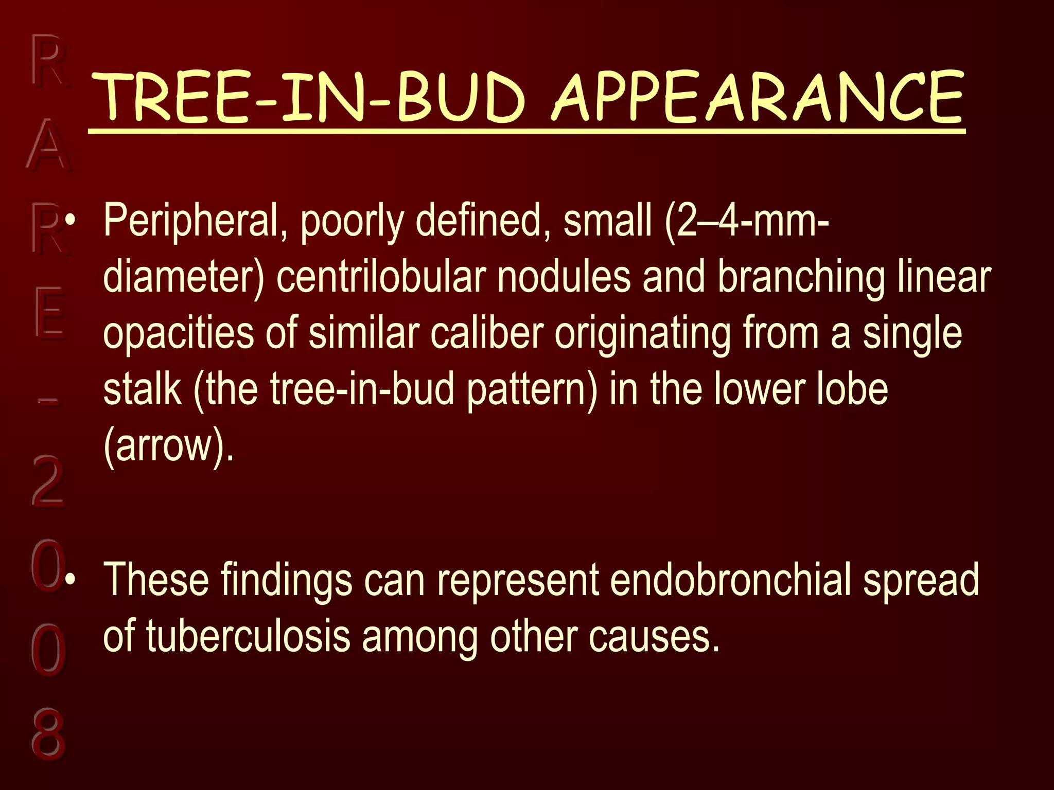 Respiratory system signs final.ppt radiology | PPT