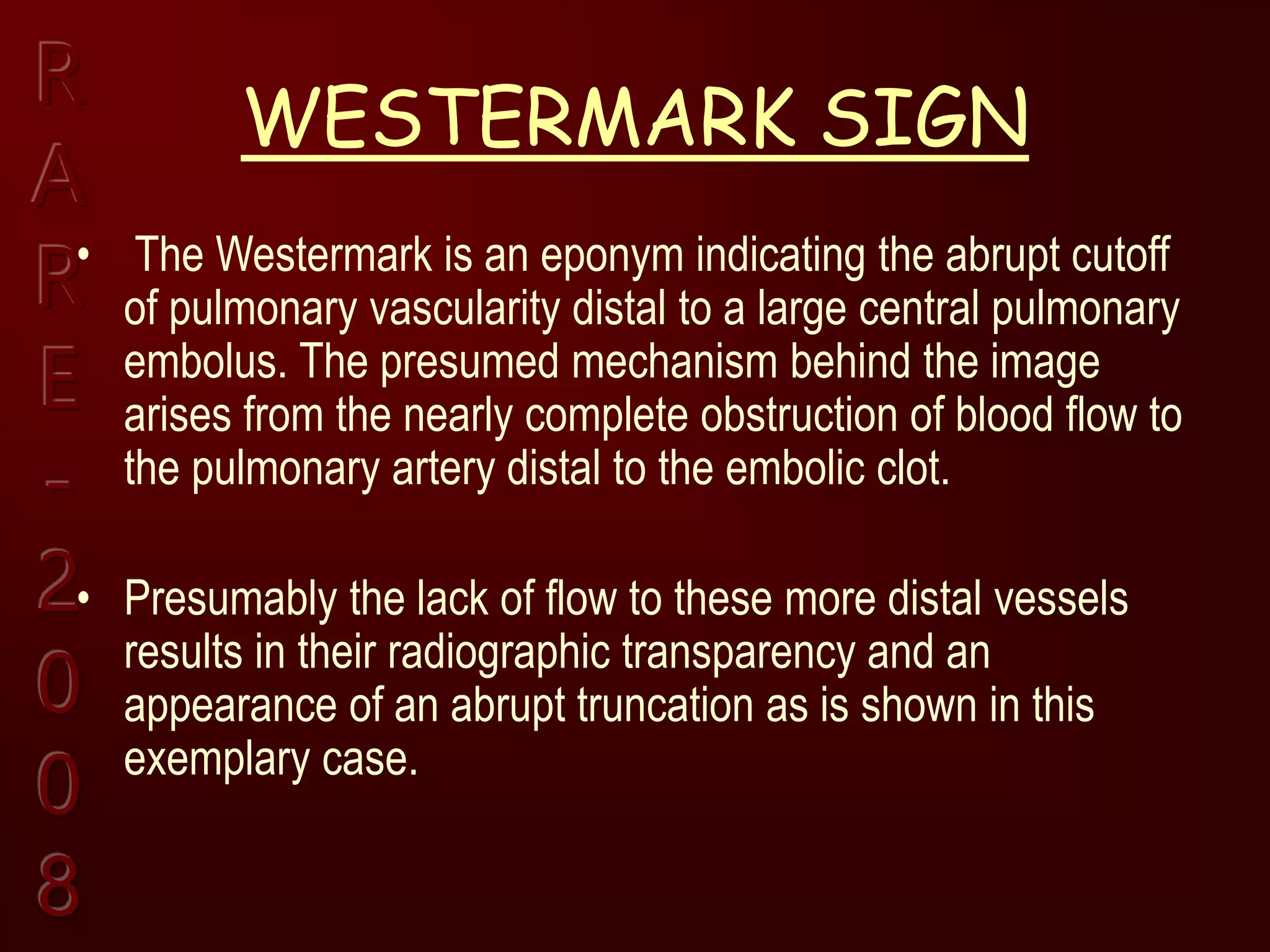 Respiratory system signs final.ppt radiology | PPT