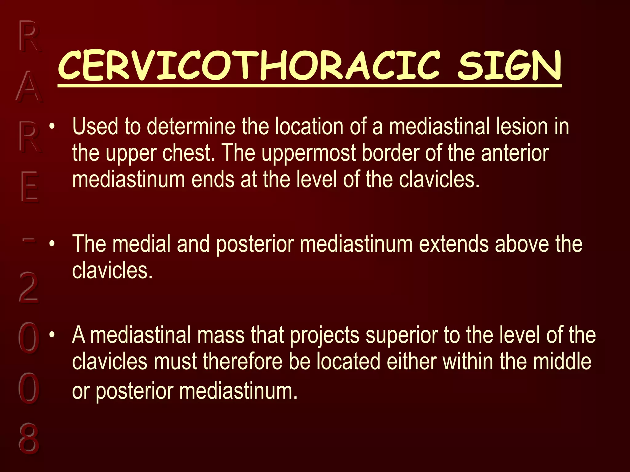 Respiratory system signs final.ppt radiology | PPT