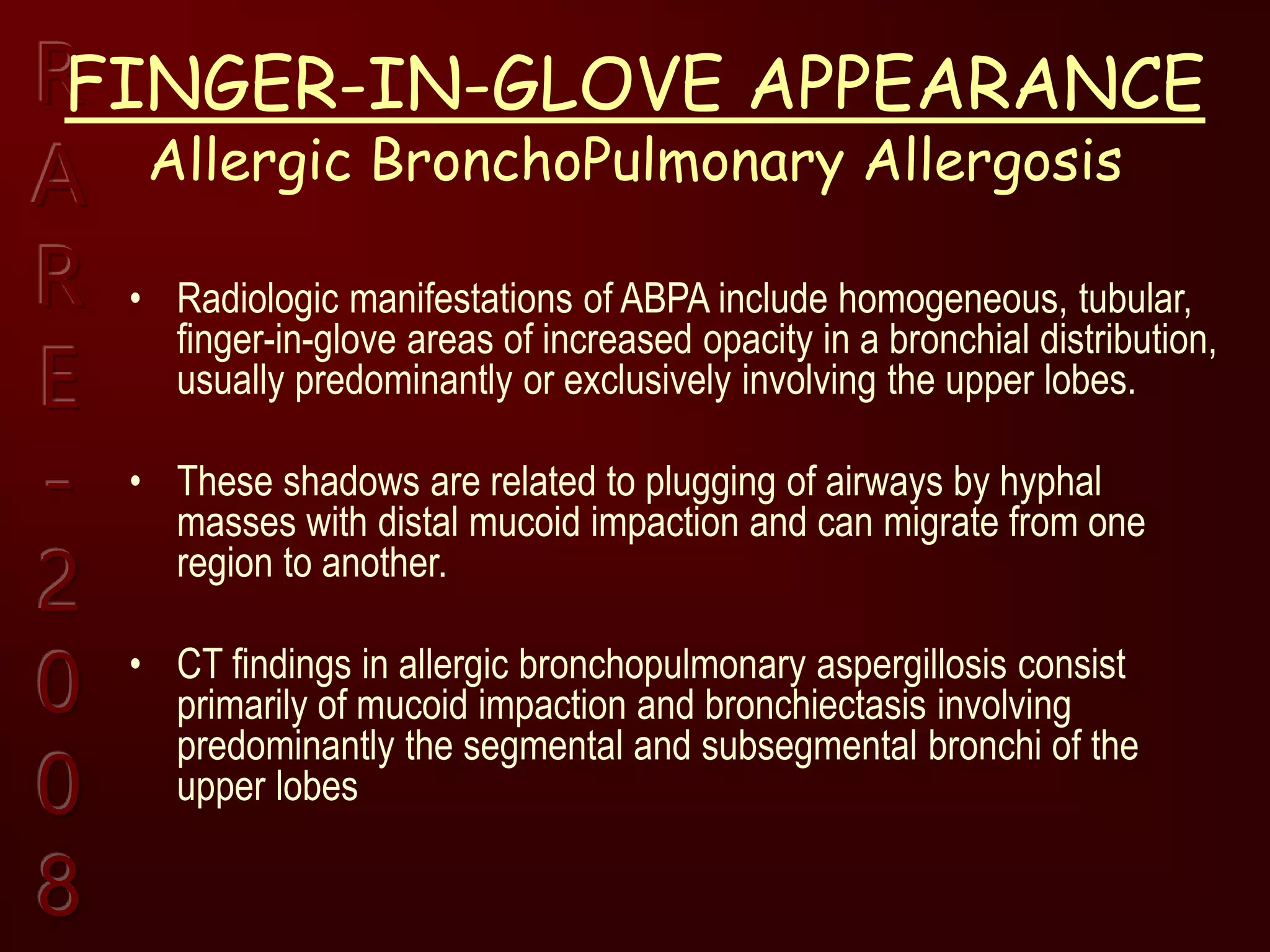Respiratory system signs final.ppt radiology | PPT
