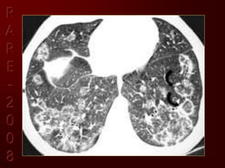 Respiratory system signs final.ppt radiology | PPT
