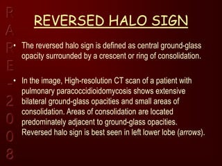 Respiratory system signs final.ppt radiology | PPT