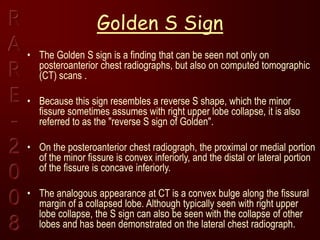 Respiratory system signs final.ppt radiology | PPT