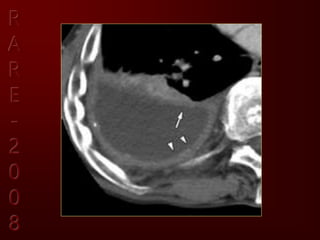 Respiratory system signs final.ppt radiology | PPT