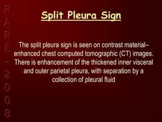 Respiratory system signs final.ppt radiology | PPT