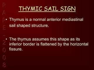 Respiratory system signs final.ppt radiology | PPT