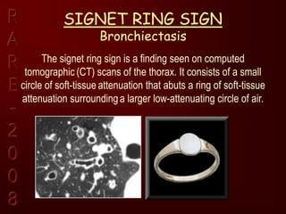 Respiratory system signs final.ppt radiology | PPT