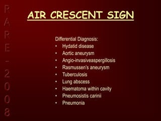 Respiratory system signs final.ppt radiology | PPT