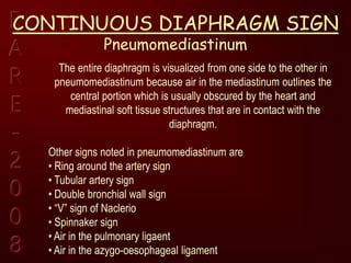 Respiratory system signs final.ppt radiology | PPT
