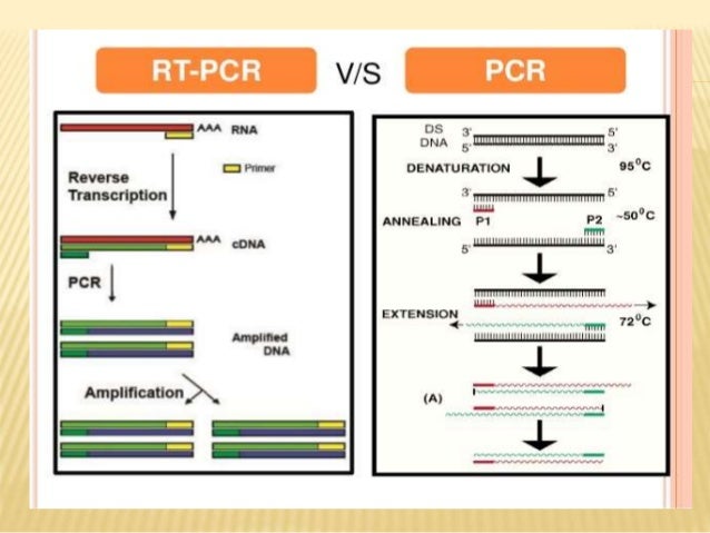 RT PCR