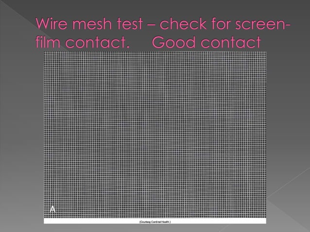 Intensifying Screen (x-ray) | PPTX