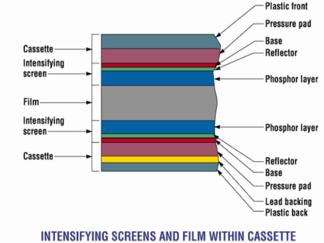 Intensifying Screen (x-ray) | PPT