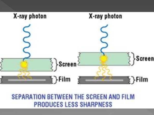 Intensifying Screen (x-ray) | PPT