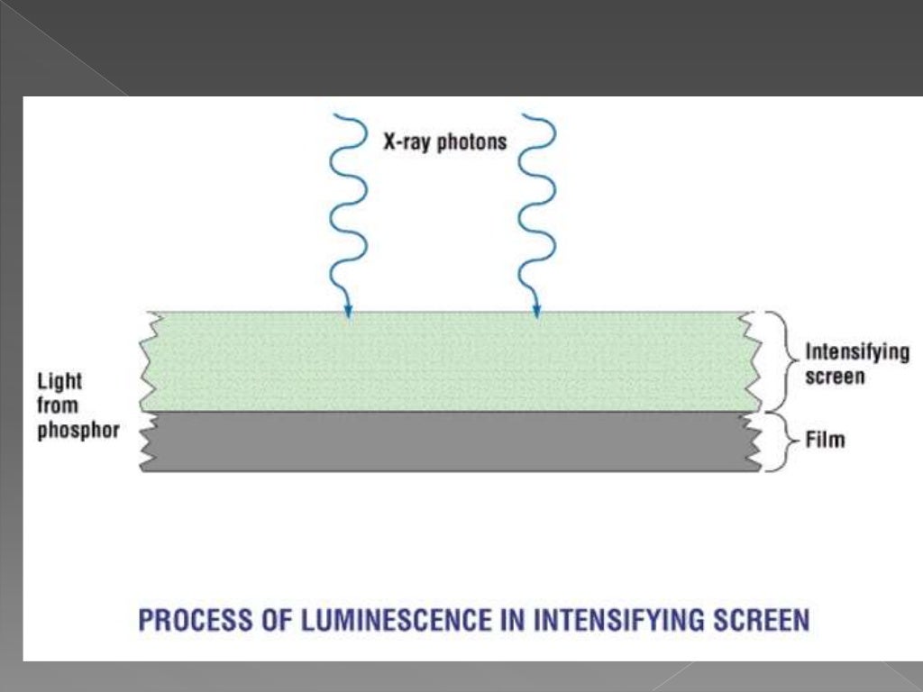 Intensifying Screen (x-ray)
