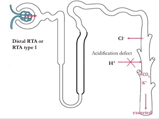 Renal tubular acidosis (pediatrics)