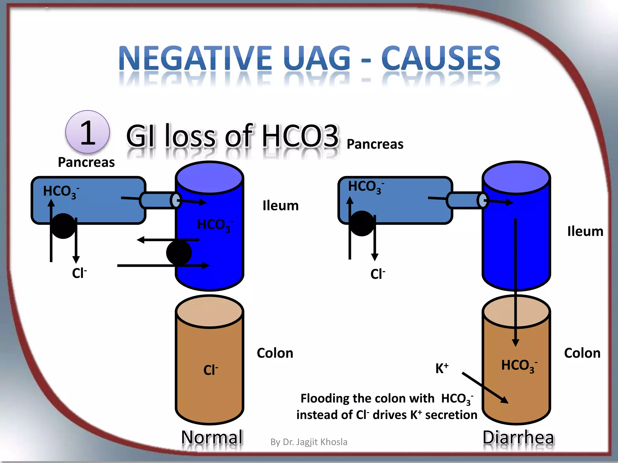 Renal tubular acidosis and other causes of Normal anion gap Metabolic ...