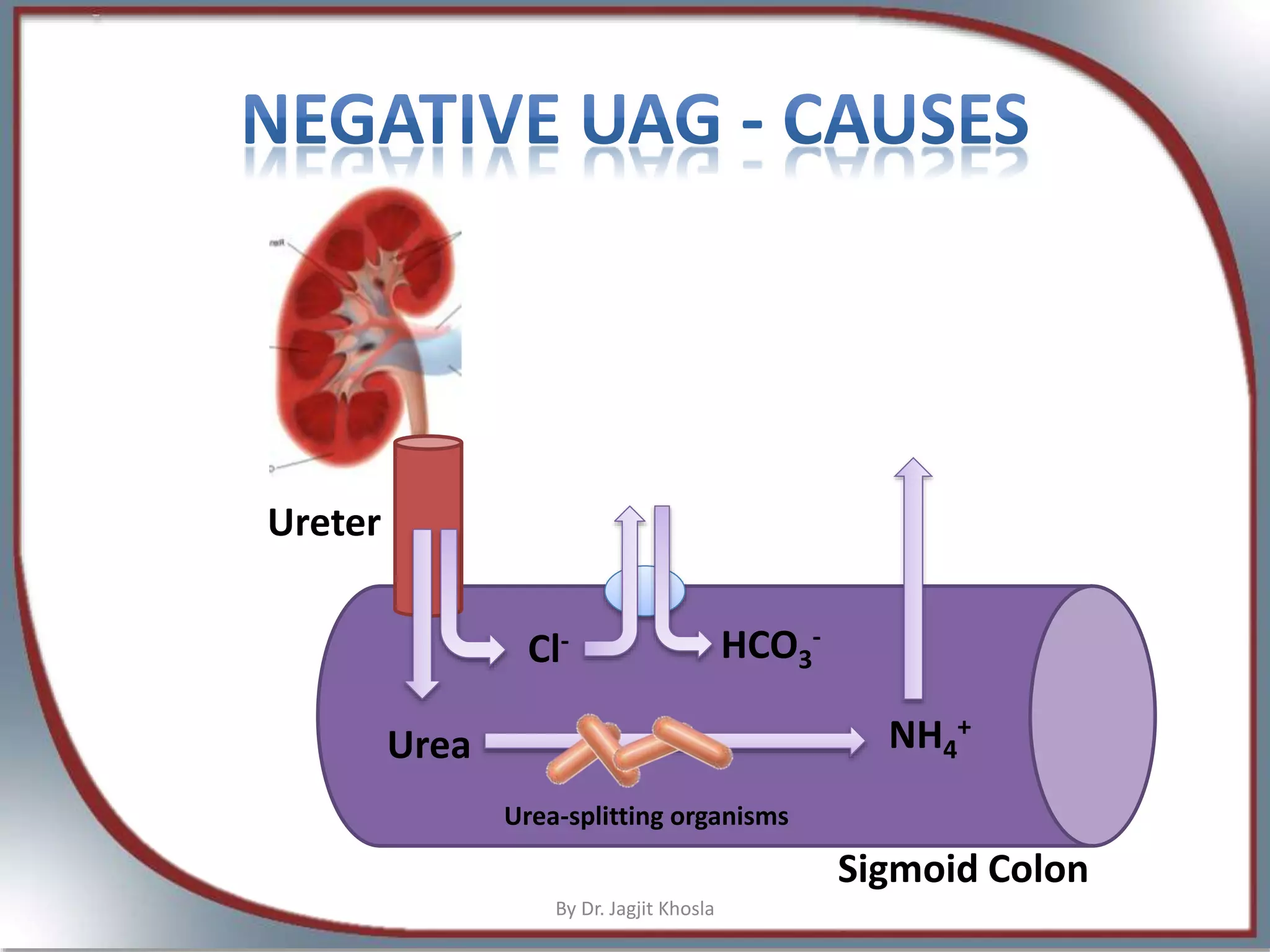 Renal tubular acidosis and other causes of Normal anion gap Metabolic ...