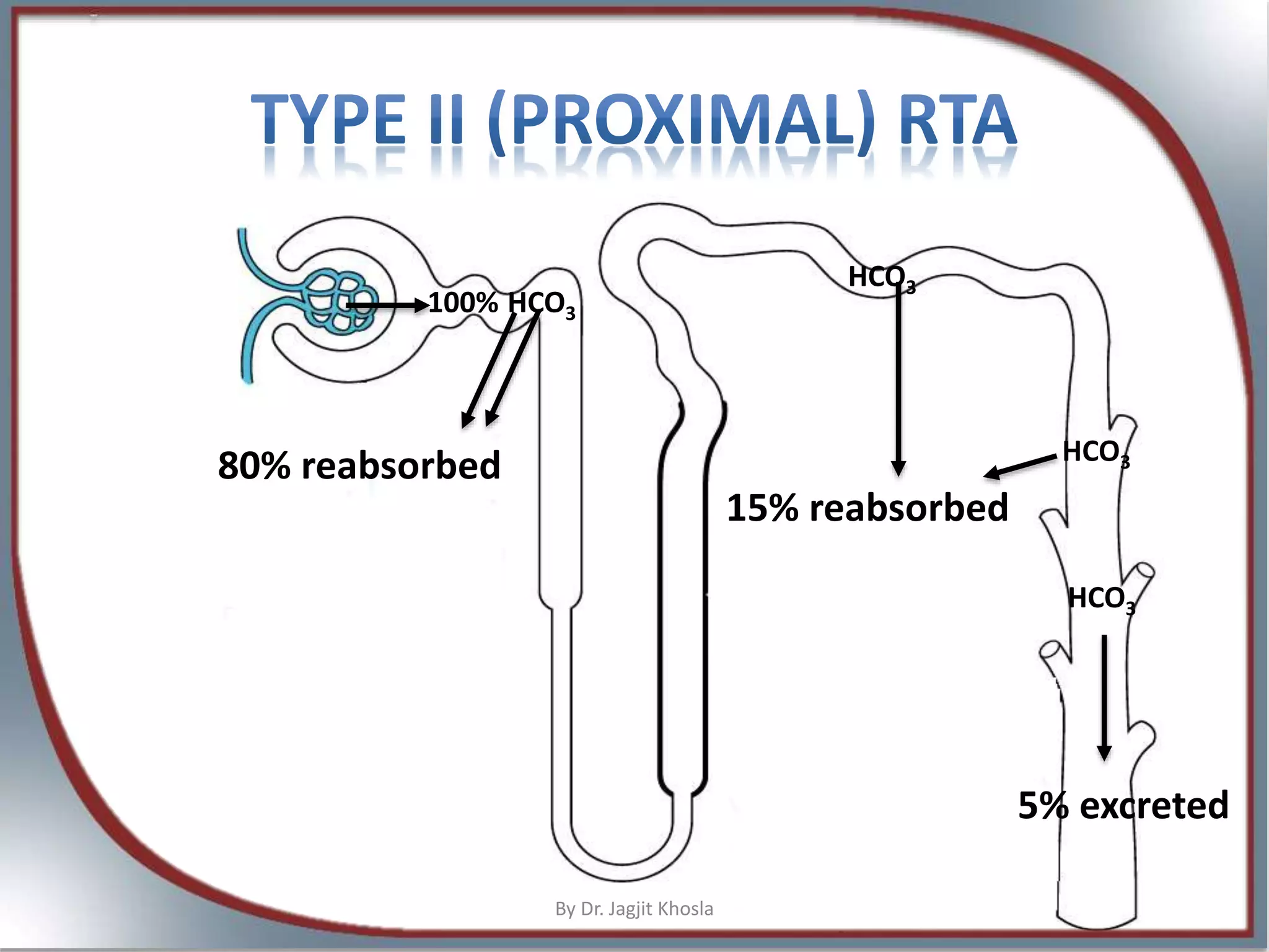 Renal tubular acidosis and other causes of Normal anion gap Metabolic ...