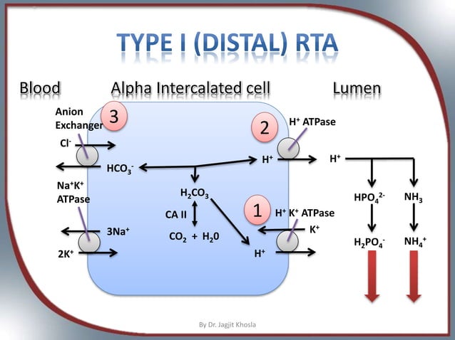 Renal tubular acidosis and other causes of Normal anion gap Metabolic ...