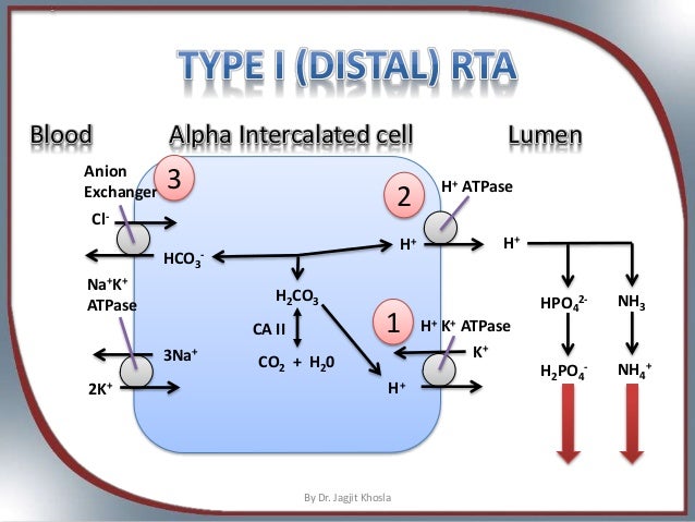 Renal tubular acidosis and other causes of Normal anion gap Metabolic…