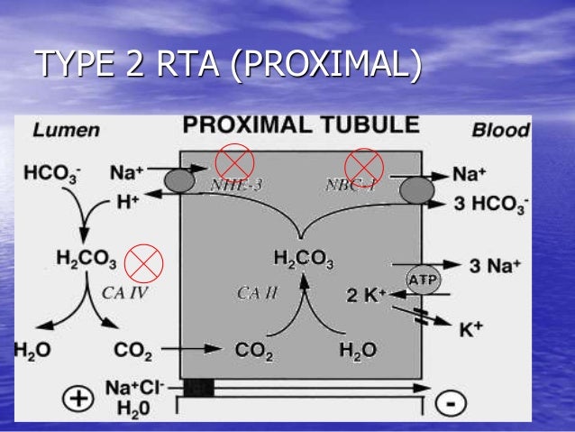 RENAL TUBULAR ACIDOSIS