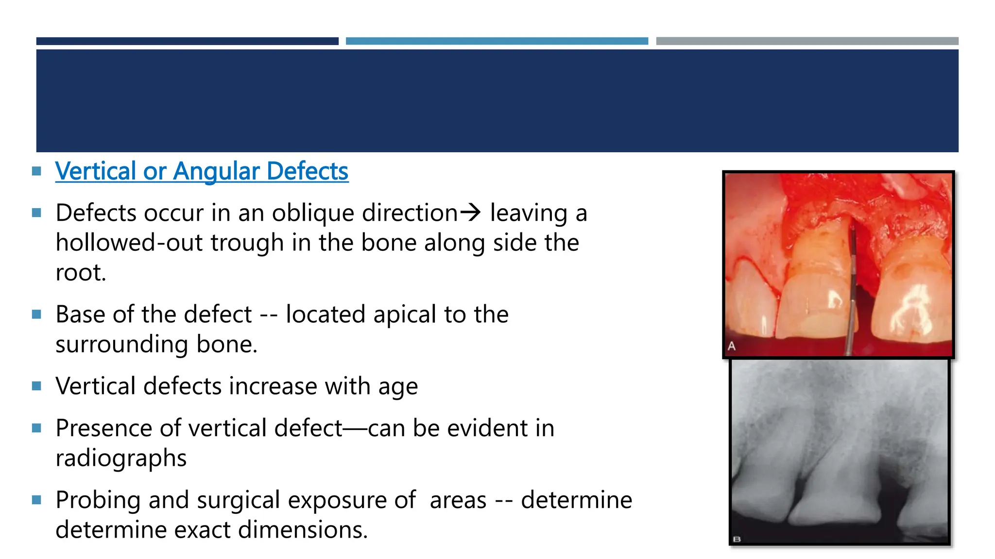 BONE LOSS PATTERN in periodontal diseasepptx | PPTX