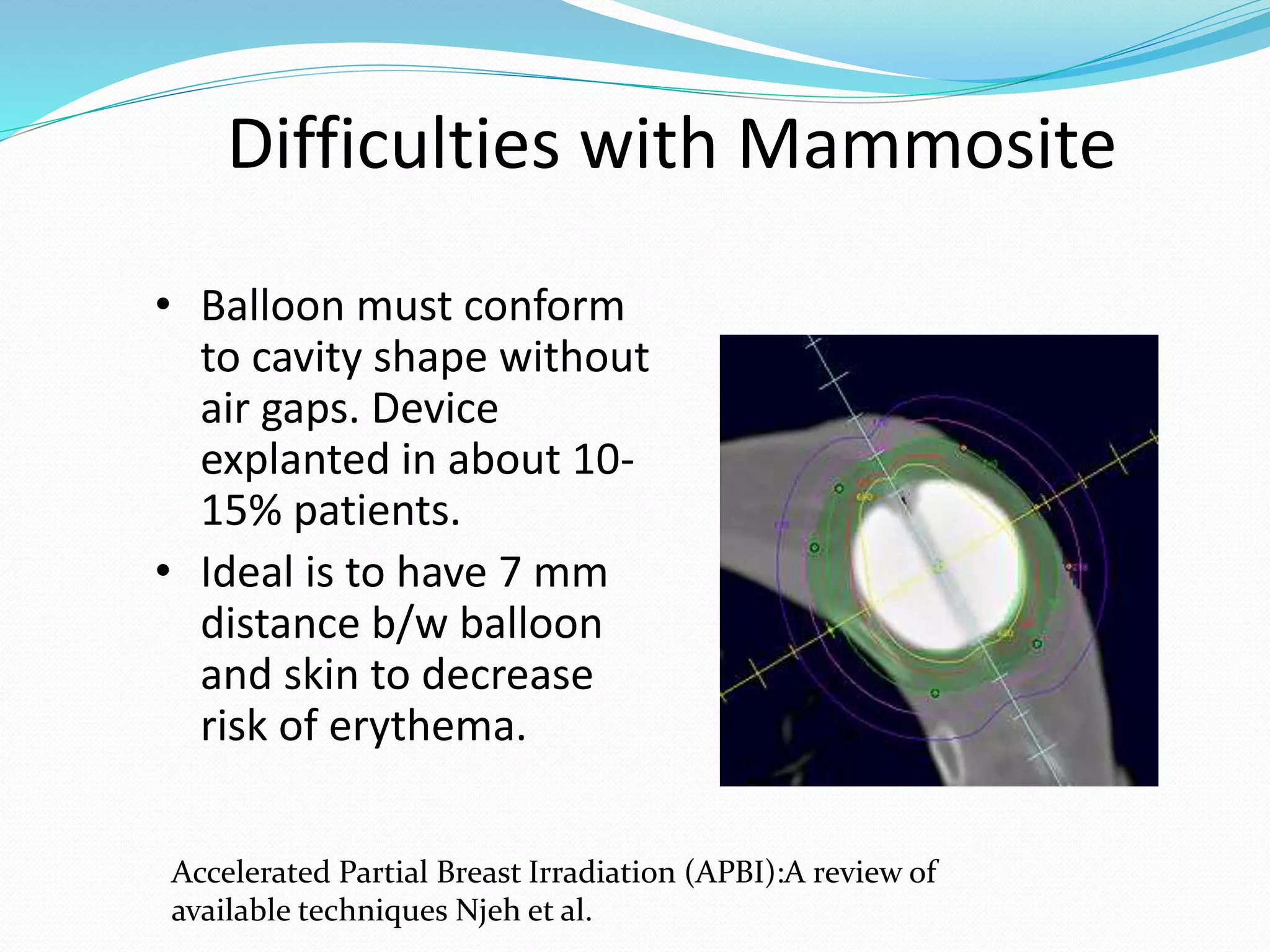 RT breast apbi | PPTX