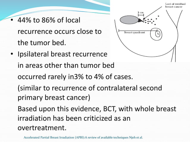 RT breast apbi | PPTX