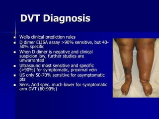 RTC DVT AND PE.ppt
