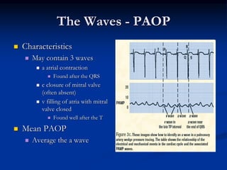 RTC PA CATHETER.ppt