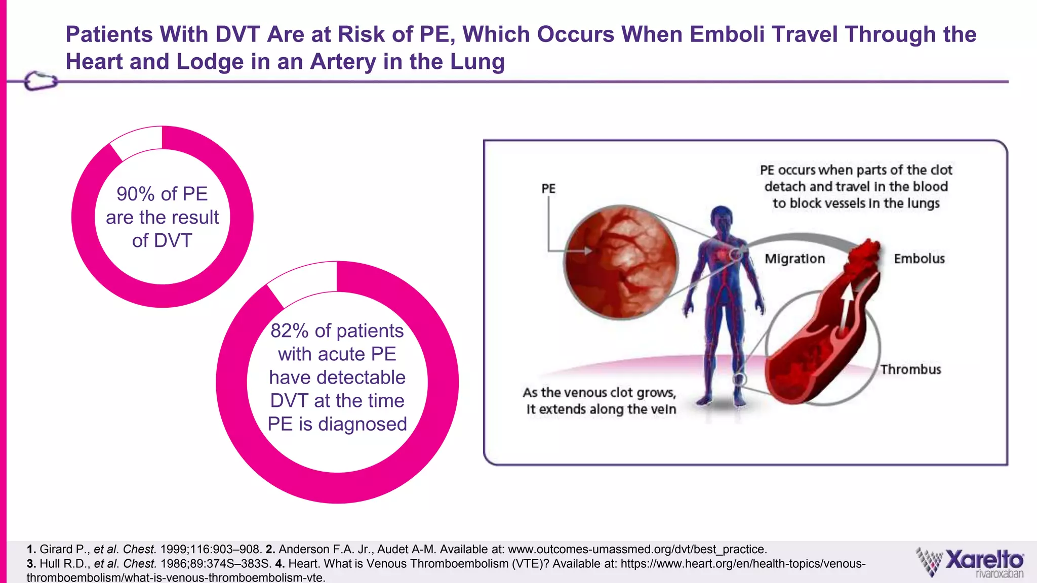 RTD - Xarelto for Venous Thromboembolism (VTE) Patients.pptx