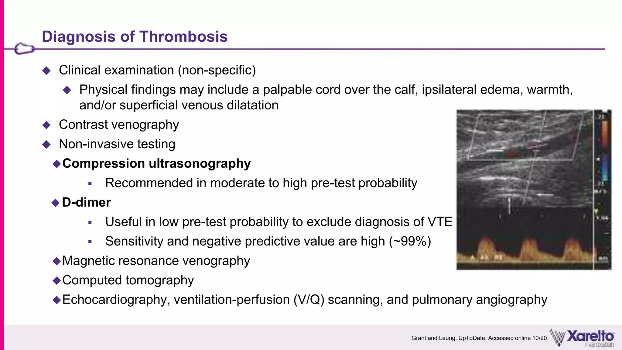 RTD - Xarelto for Venous Thromboembolism (VTE) Patients.pptx
