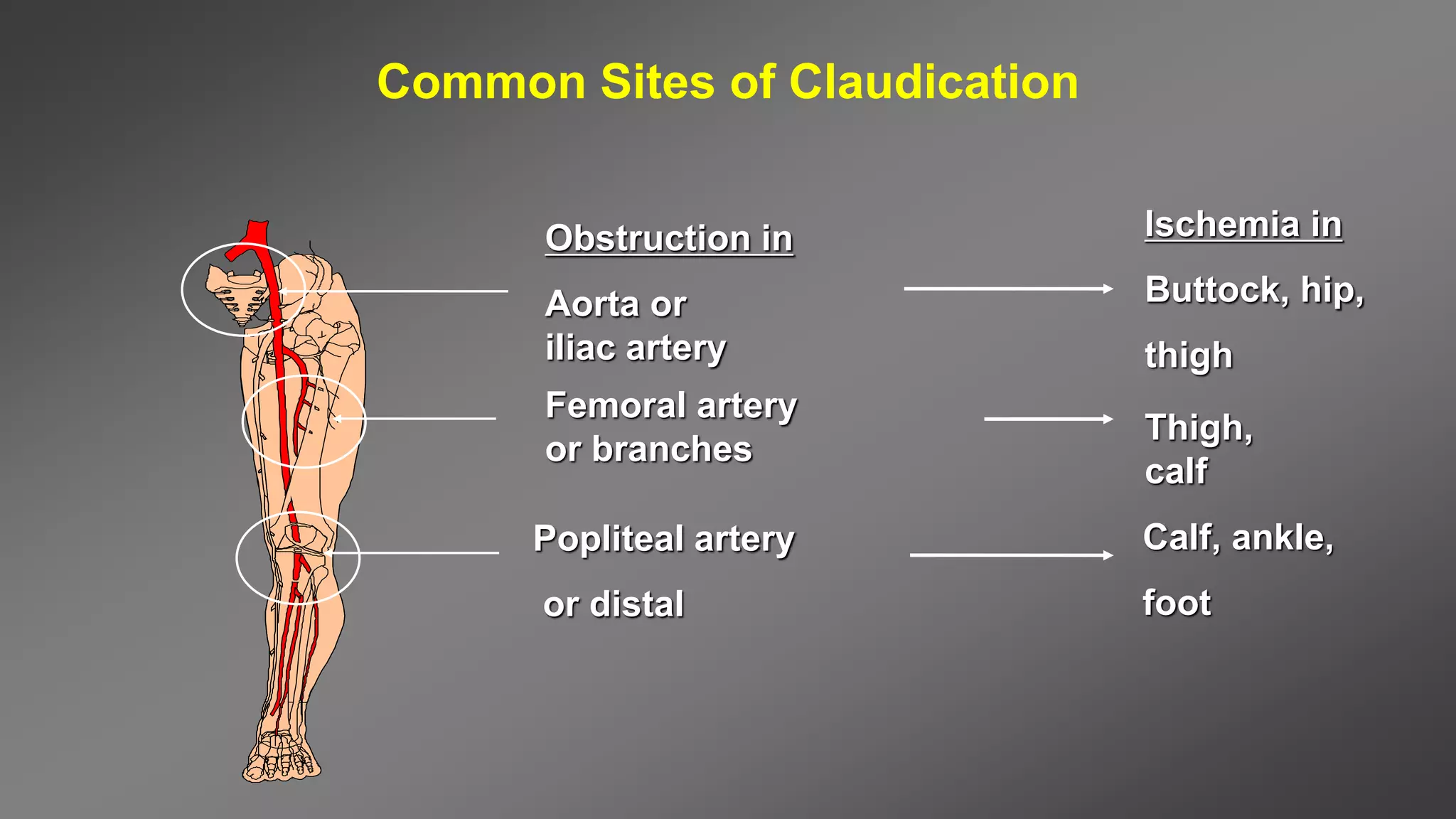 RTD - Xarelto for Venous Thromboembolism (VTE) Patients.pptx