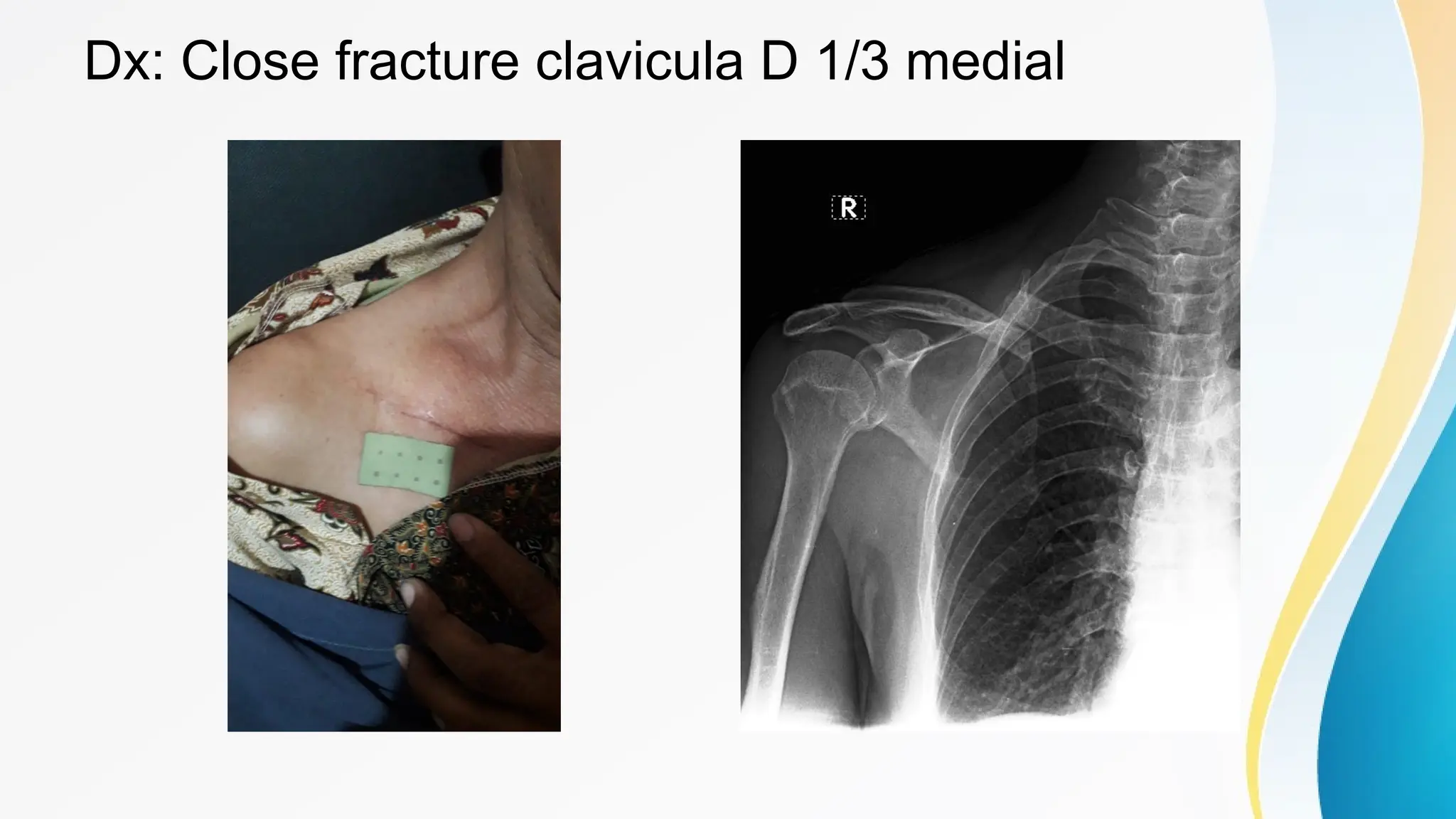 RTD radiologi RTD radiologiRTD radiologiRTD radiologiRTD radiologiRTD ...